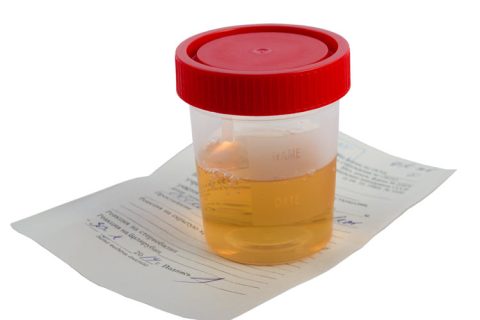 Urinary Infection Prevention and SCI | Neurogenic Bowel Care